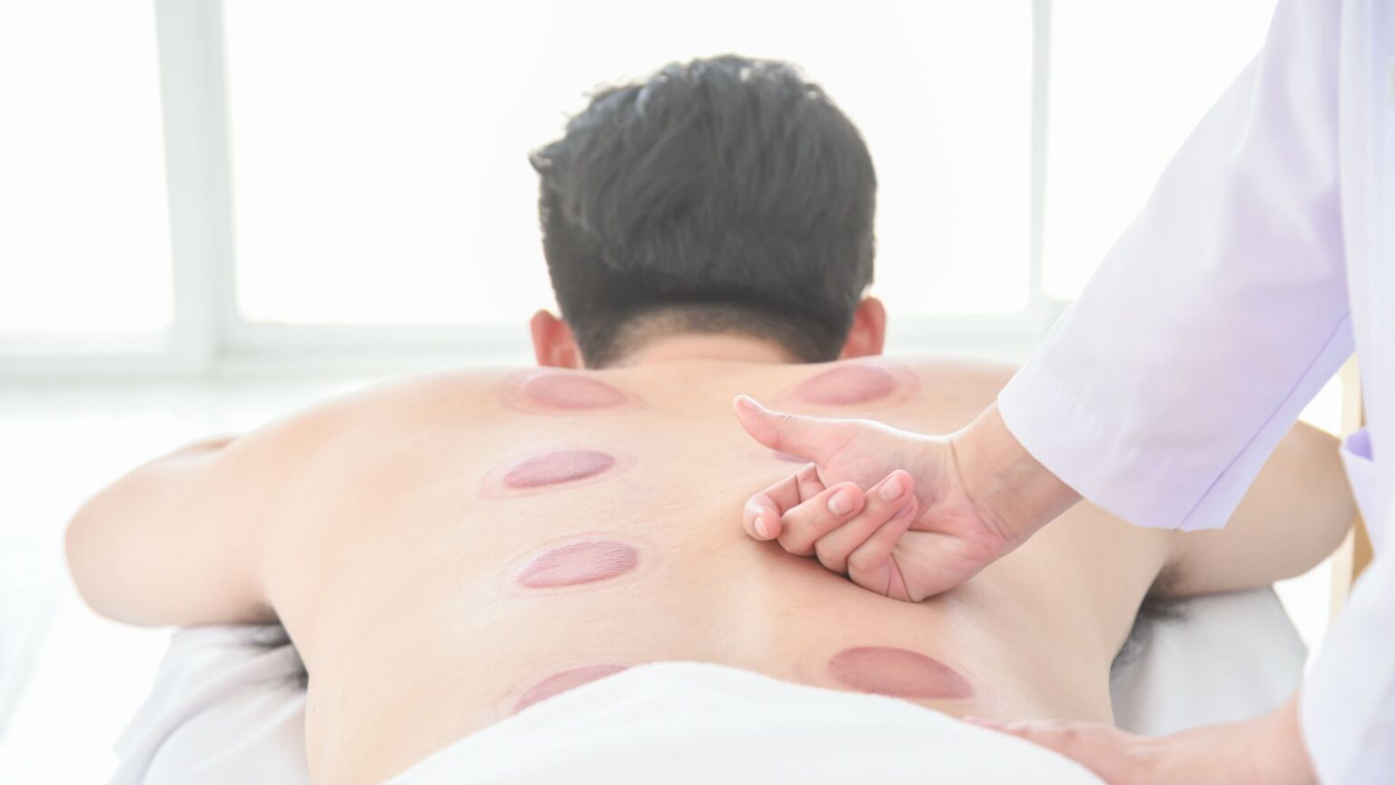 Cupping Therapy